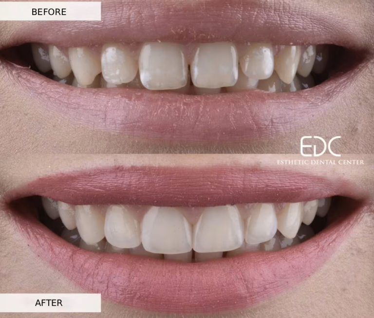 Case Studies - Esthetic Dental Center